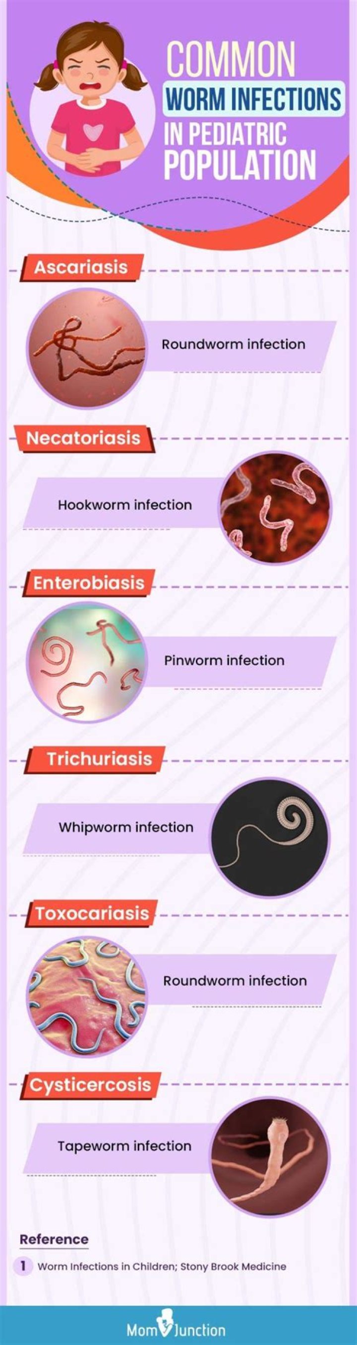 Can you see human pinworms? - TruthTrack News
